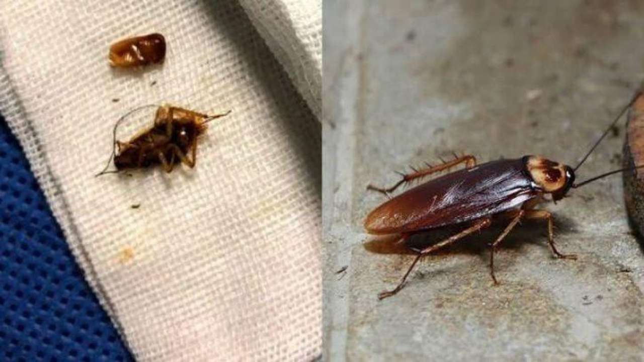 Cockroaches found living inside Chinese man’s ear